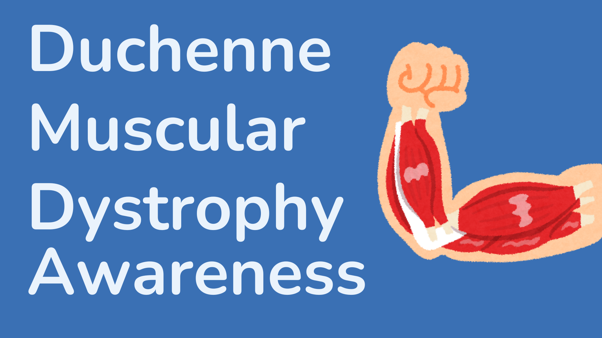 5 Ways Pediatric Physical Therapy Supports Children with Duchenne ...